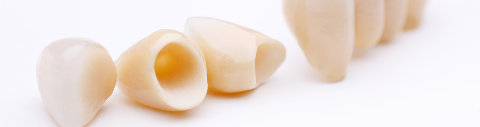 Kroon plaatsen | Mondzorg Galgenwaard