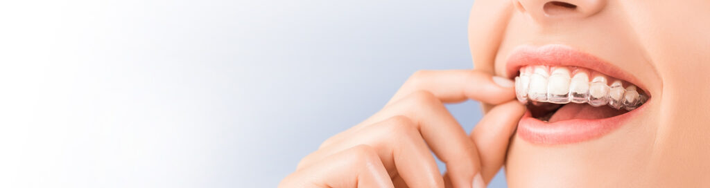 Opbeetplaat | Mondzorg Galgenwaard